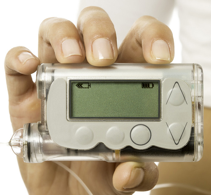 Fralock History | Custom Engineered Solutions Provider